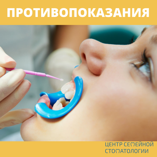 Покрытие зубов фтор-препаратами в Минске, цены на глубокое фторирование